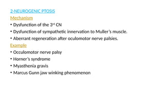 THE PTOSIS (the eye droopng disease) .pptx