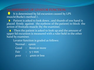 Ptosis bdm copy | PPT