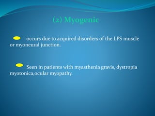 Ptosis bdm copy | PPT
