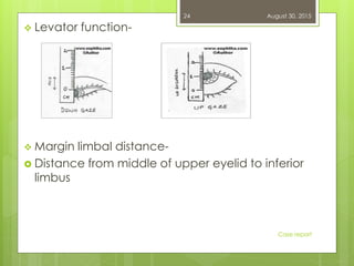 Ptosis case report | PPTX