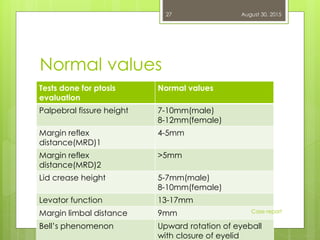 Ptosis case report | PPTX