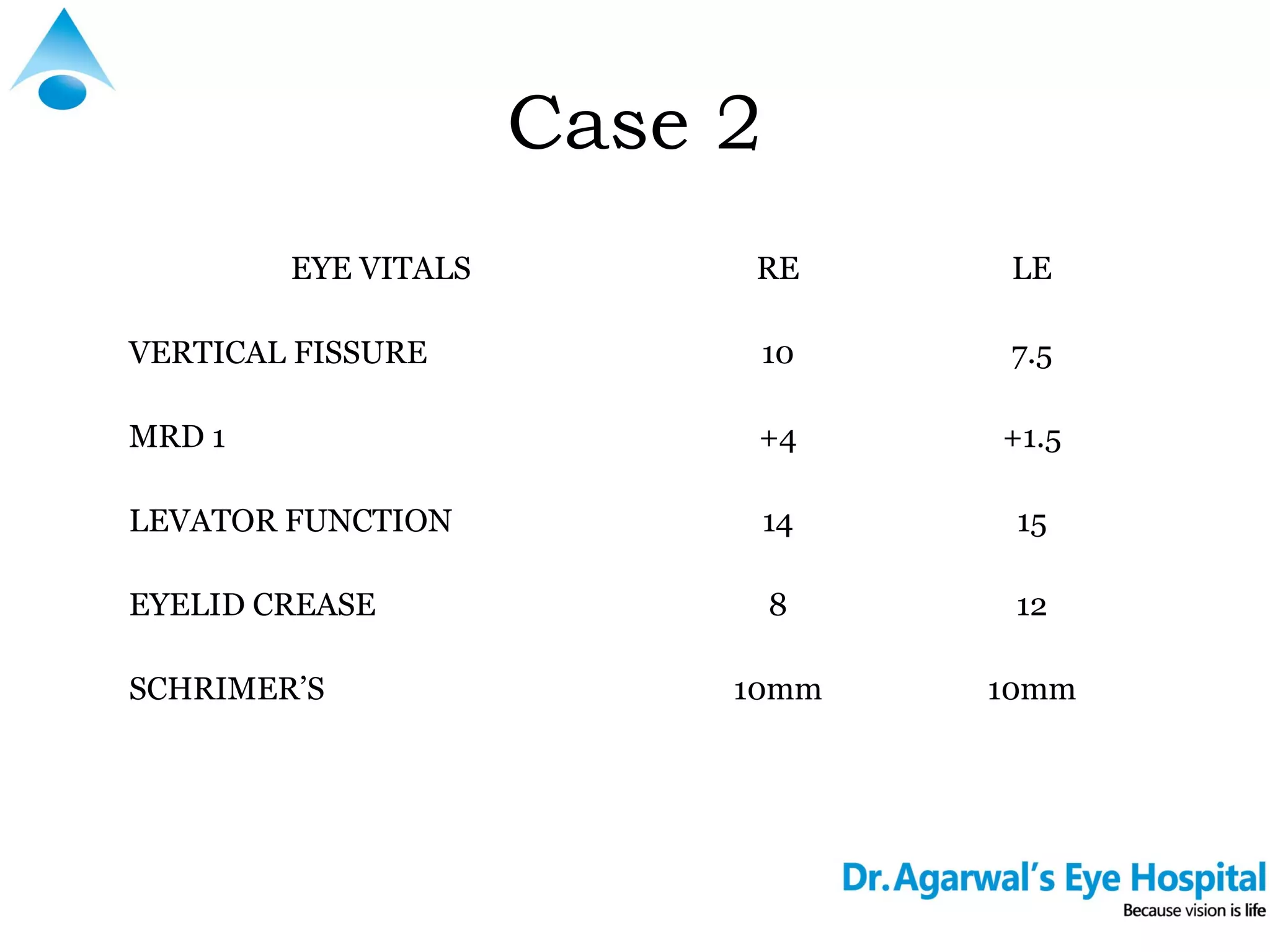 Ptosis - Dr.Divya | PPT