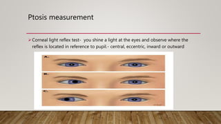 Ptosis Evaluation.pptx