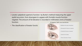 Ptosis Evaluation.pptx