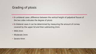 Ptosis Evaluation.pptx
