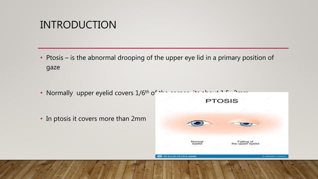 Ptosis Evaluation.pptx