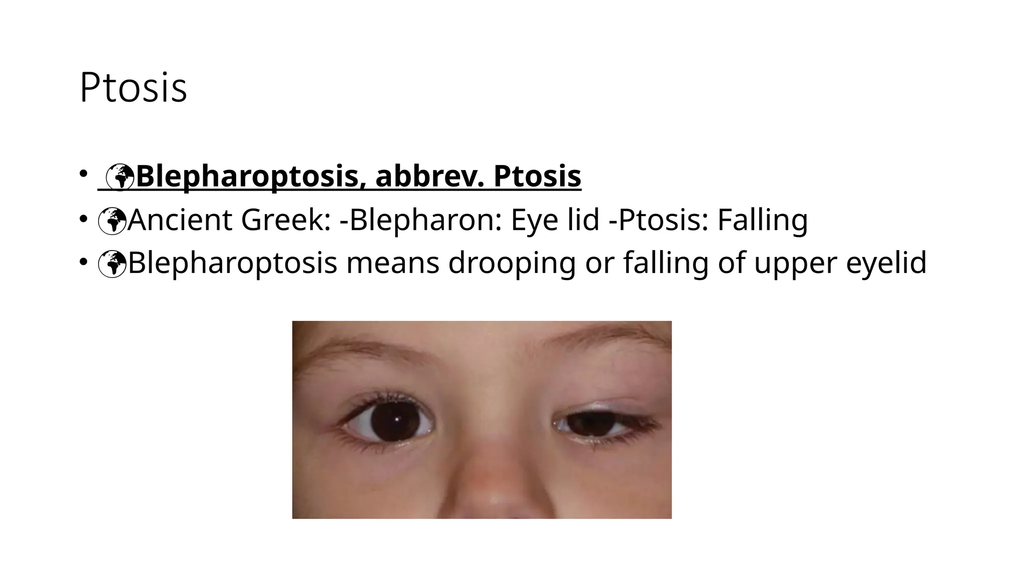 Ptosis Explanation for junior ophthalmoogist.pptx