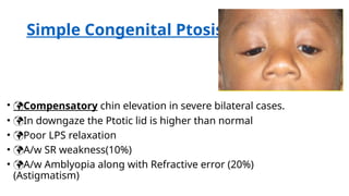 Ptosis Explanation for junior ophthalmoogist.pptx