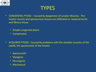 PTOSIS . CLINICAL FEATURES . DIAGNOSIS . MANAGMENT LINES | PPTX