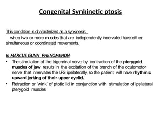 Case of ptosis and it’s diagnosis and management | PPTX