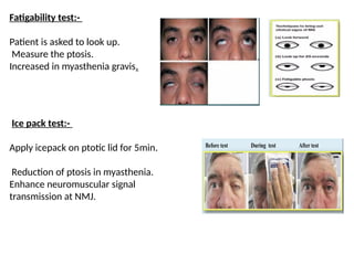 Case of ptosis and it’s diagnosis and management | PPTX