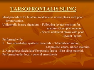 Ptosis surgery | PPTX