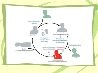 Pulmonary Tuberculosis - Phthisis[1].pptx
