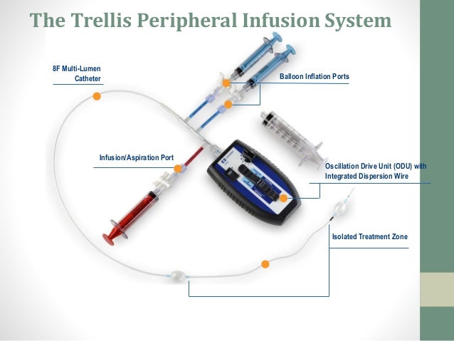 Iliofemoral DVT thrombolysis