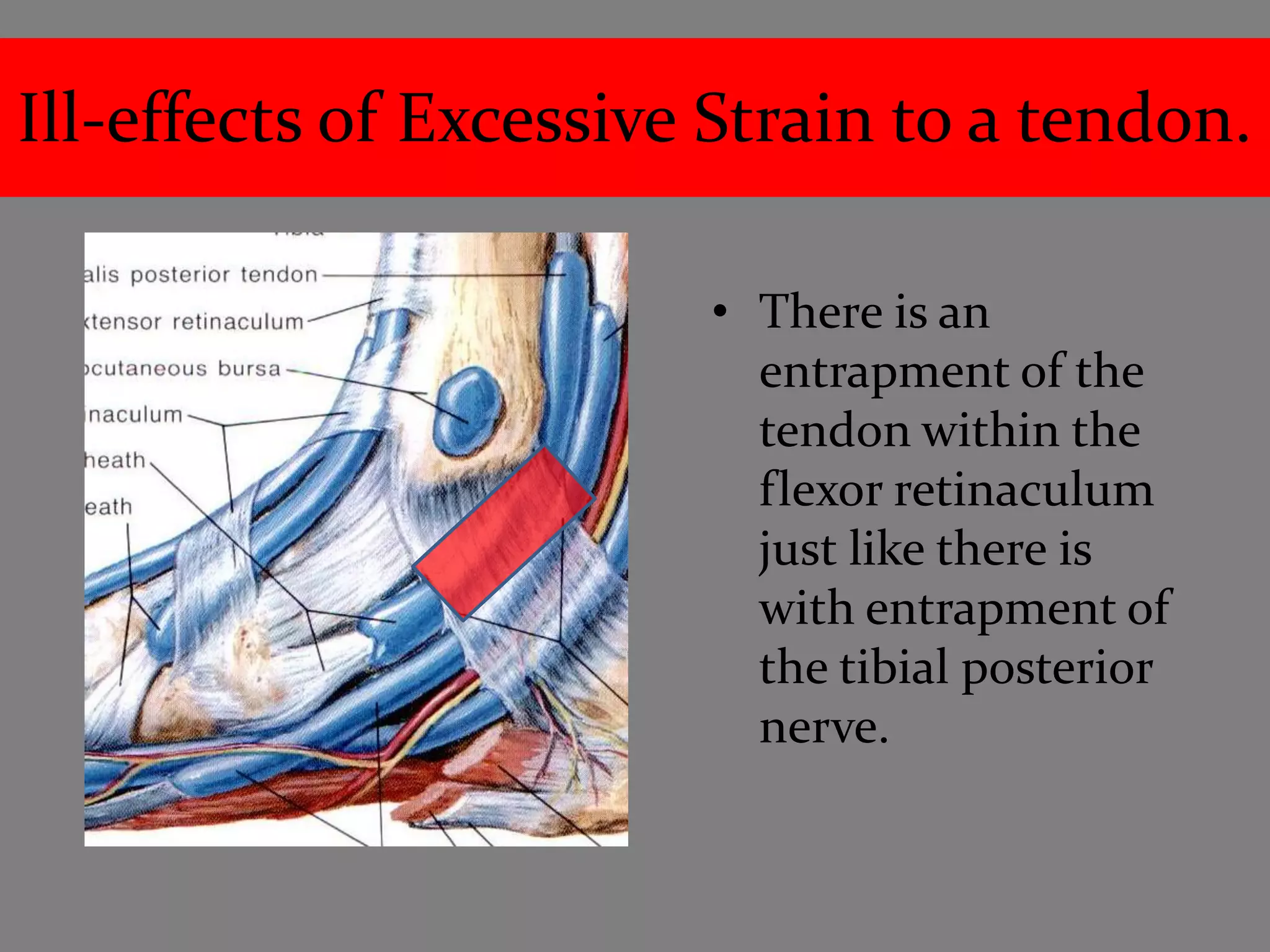 Posterior Tibial Tendon Dysfunction | PDF