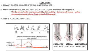 PTTD - Acquired Pes Planus | PDF