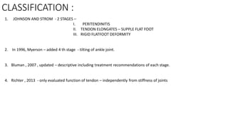PTTD - Acquired Pes Planus | PDF