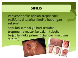 PTT HIV, varisela dll.pdf