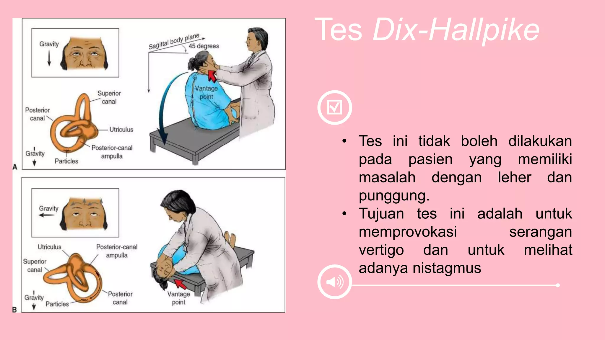 PTT_VERTIGO_PERIFER.pptx