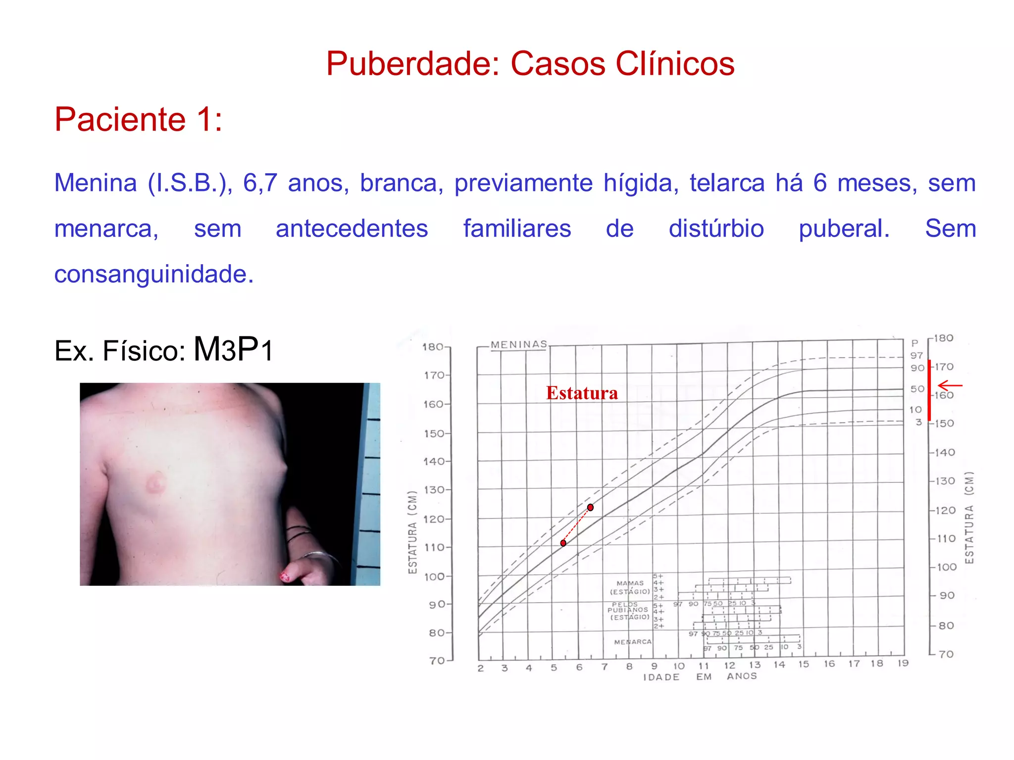 Puberdade precoce (Casos clínicos).pdf