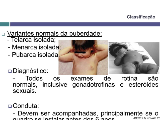 Puberdade Precoce: como conduzir | PPT