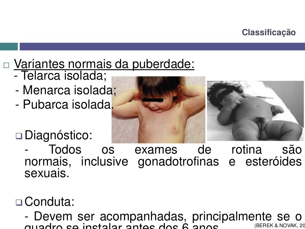 Puberdade Precoce: como conduzir