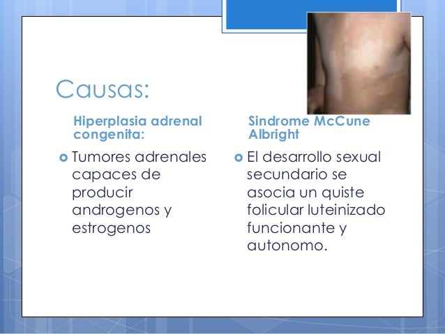 Pubertad precoz y tardia