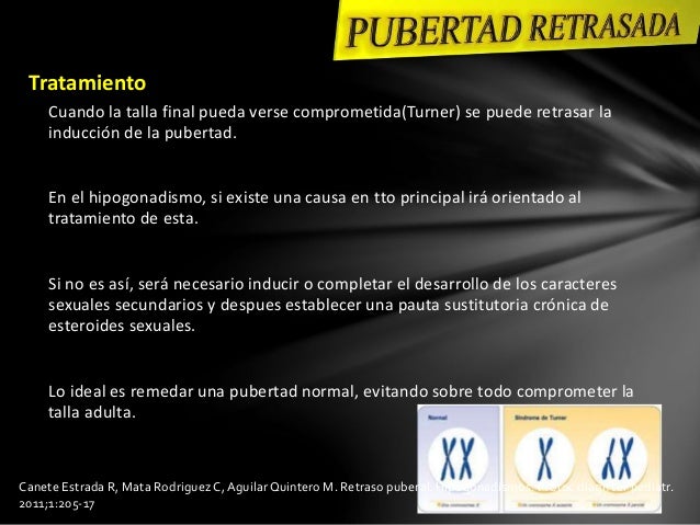 Pubertad retrasada