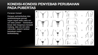 MATERI TENTANG PUBERTAS PADA MASA REMAJA | PDF