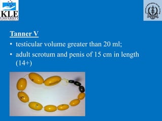 Puberty ( Assessment and Factor affecting puberty) | PPTX