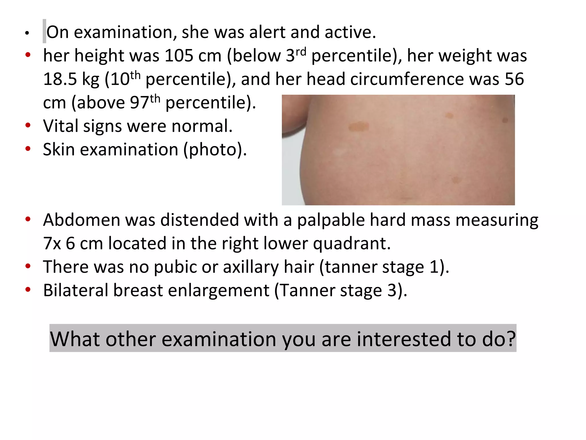 Puberty normal and precocious | PDF