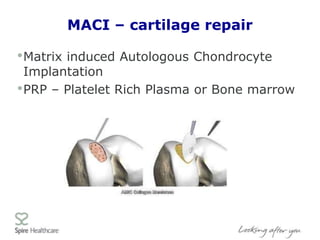 Public knee ppt | PPT