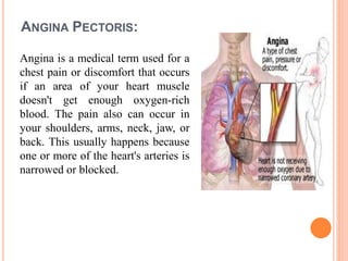 Public knowledge of cardiovascular diseases and its risk | PPTX