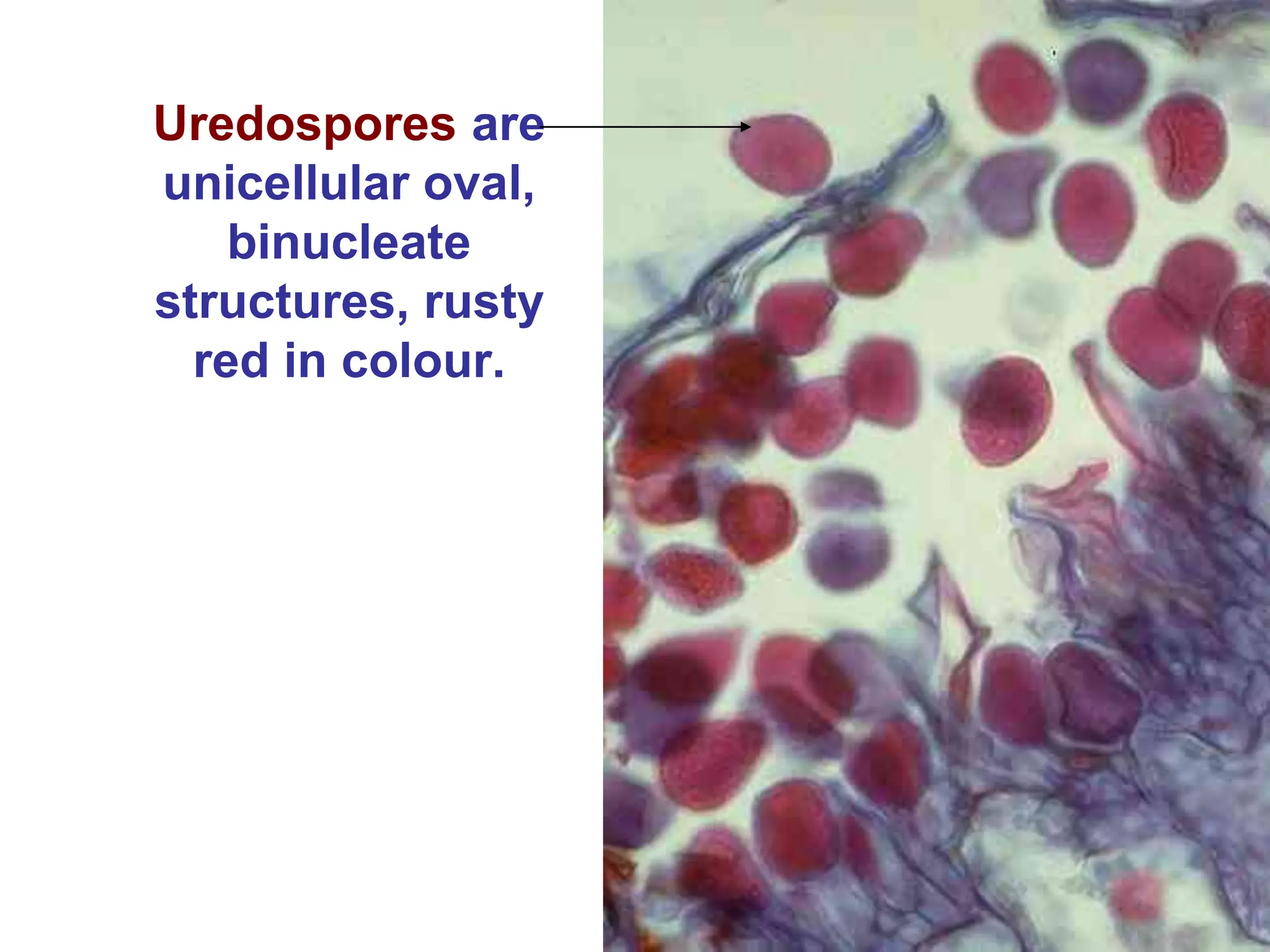 Different stages in the life cycle of Puccinia | PPTX