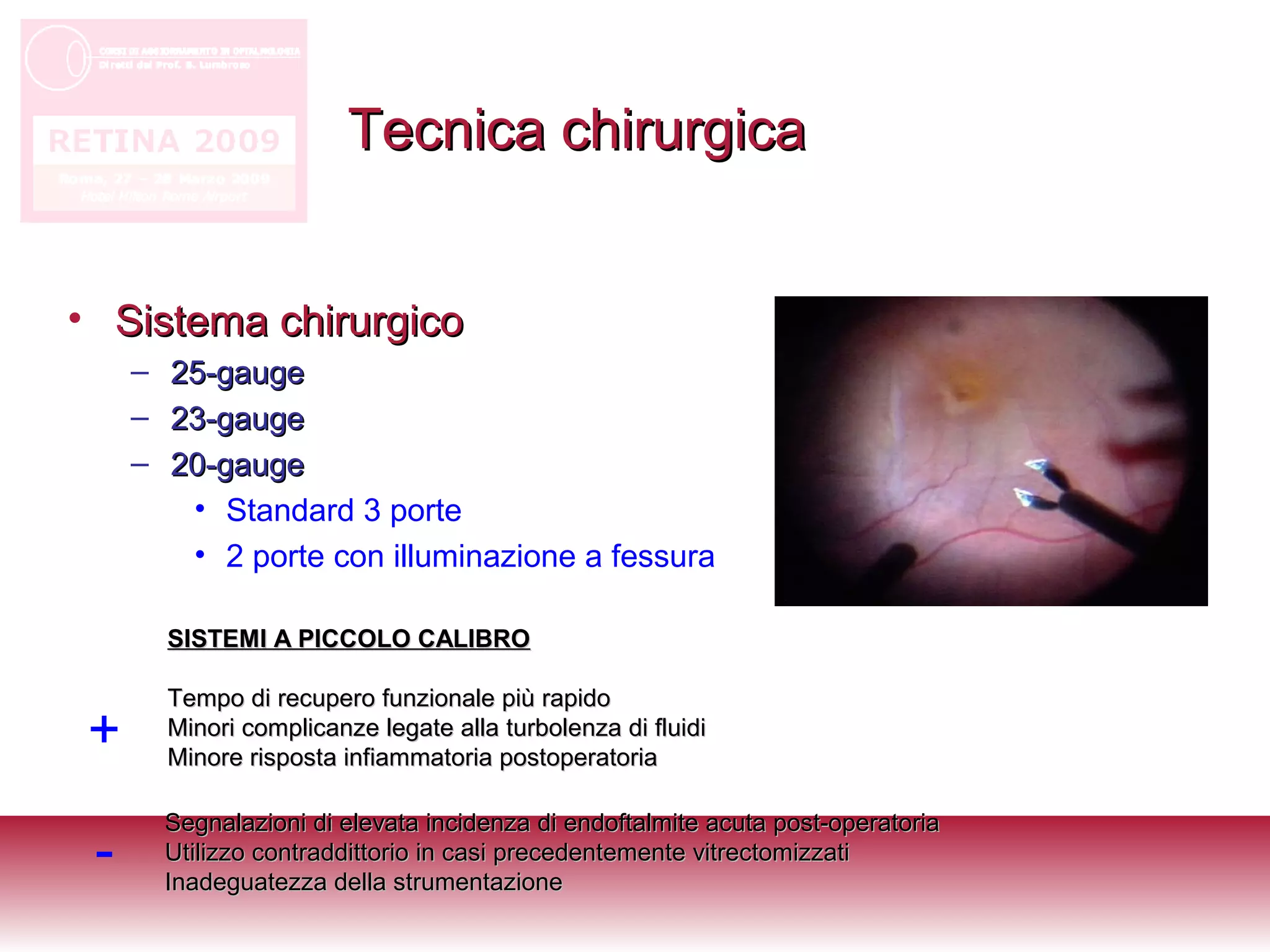 Pucker maculare | PPT