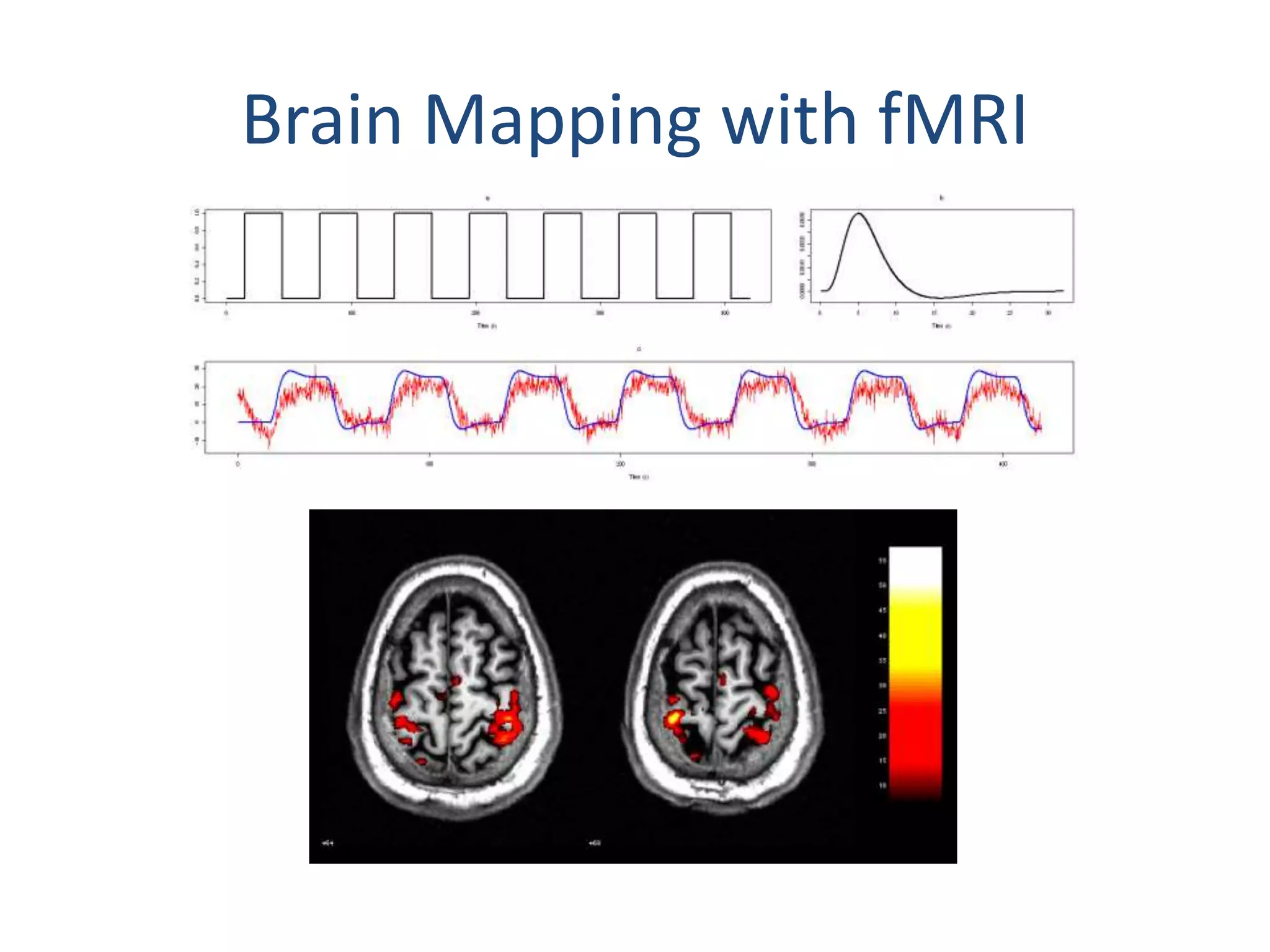 Computational Approaches For Mapping The Human Connectome Ppt