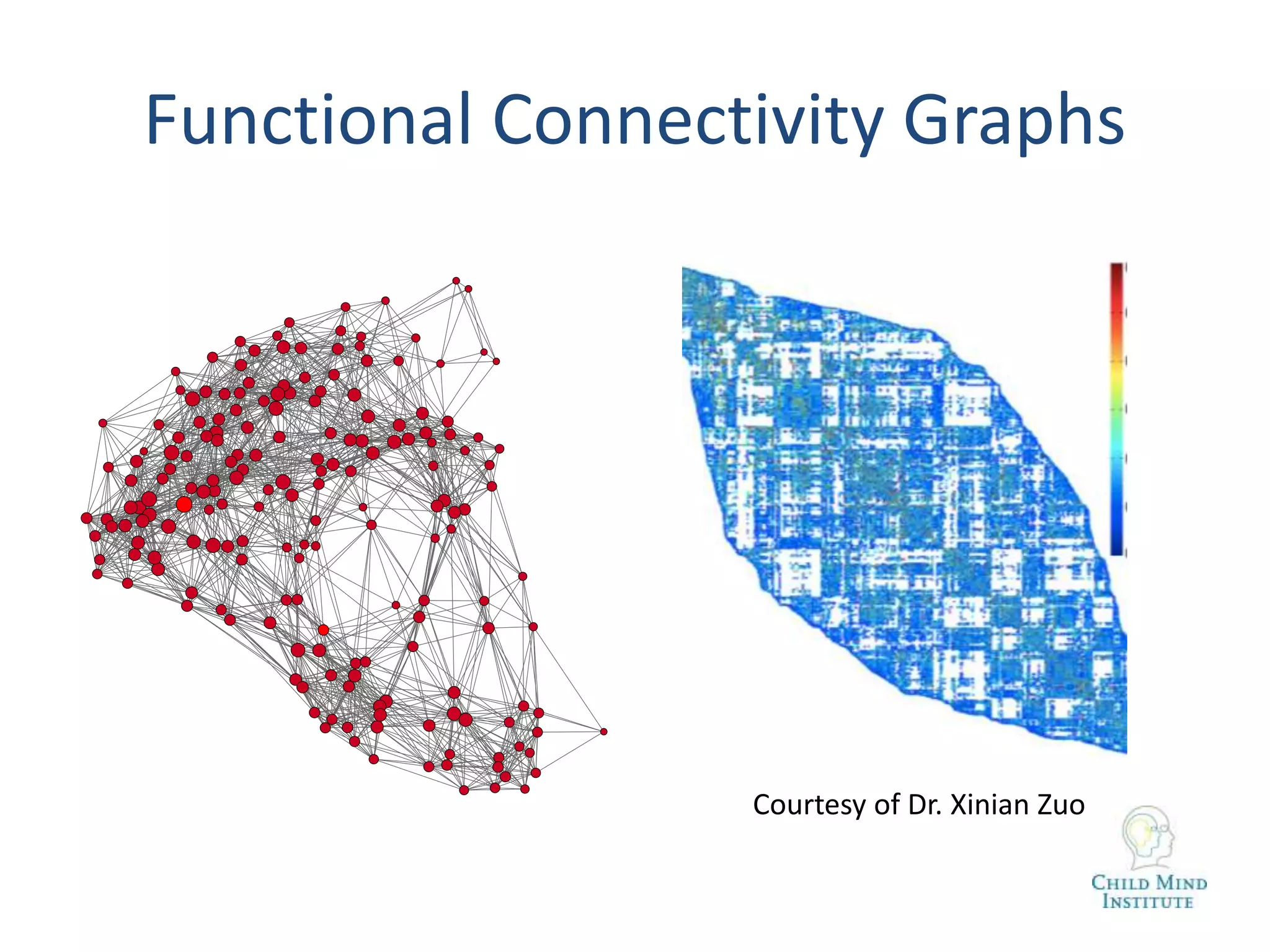 Computational Approaches For Mapping The Human Connectome Ppt