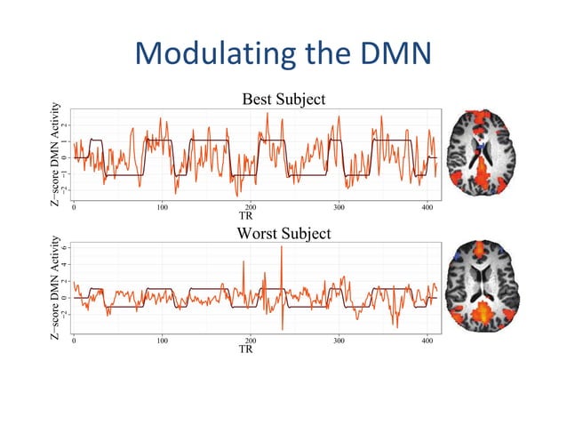 Computational Approaches For Mapping The Human Connectome Ppt