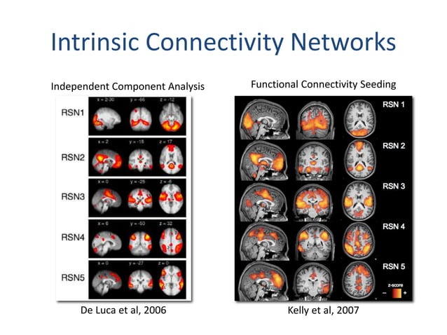 Computational Approaches For Mapping The Human Connectome Ppt