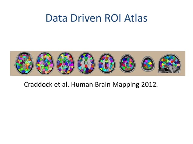 Computational Approaches For Mapping The Human Connectome Ppt