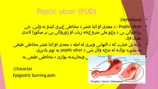 Approach to diagnosis and treatment PUD.pptx