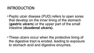 Peptic Ulcer Desease (PUD), Sores in the gastrium | PPT