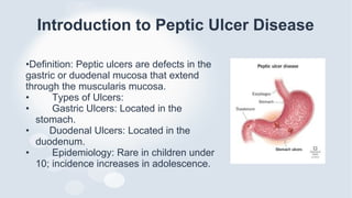 Peptic Ulcer disease (paeds medicine) Dr saad | PDF