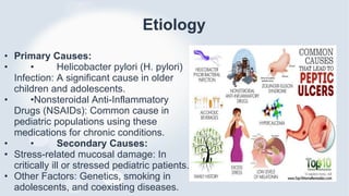 Peptic Ulcer disease (paeds medicine) Dr saad | PDF
