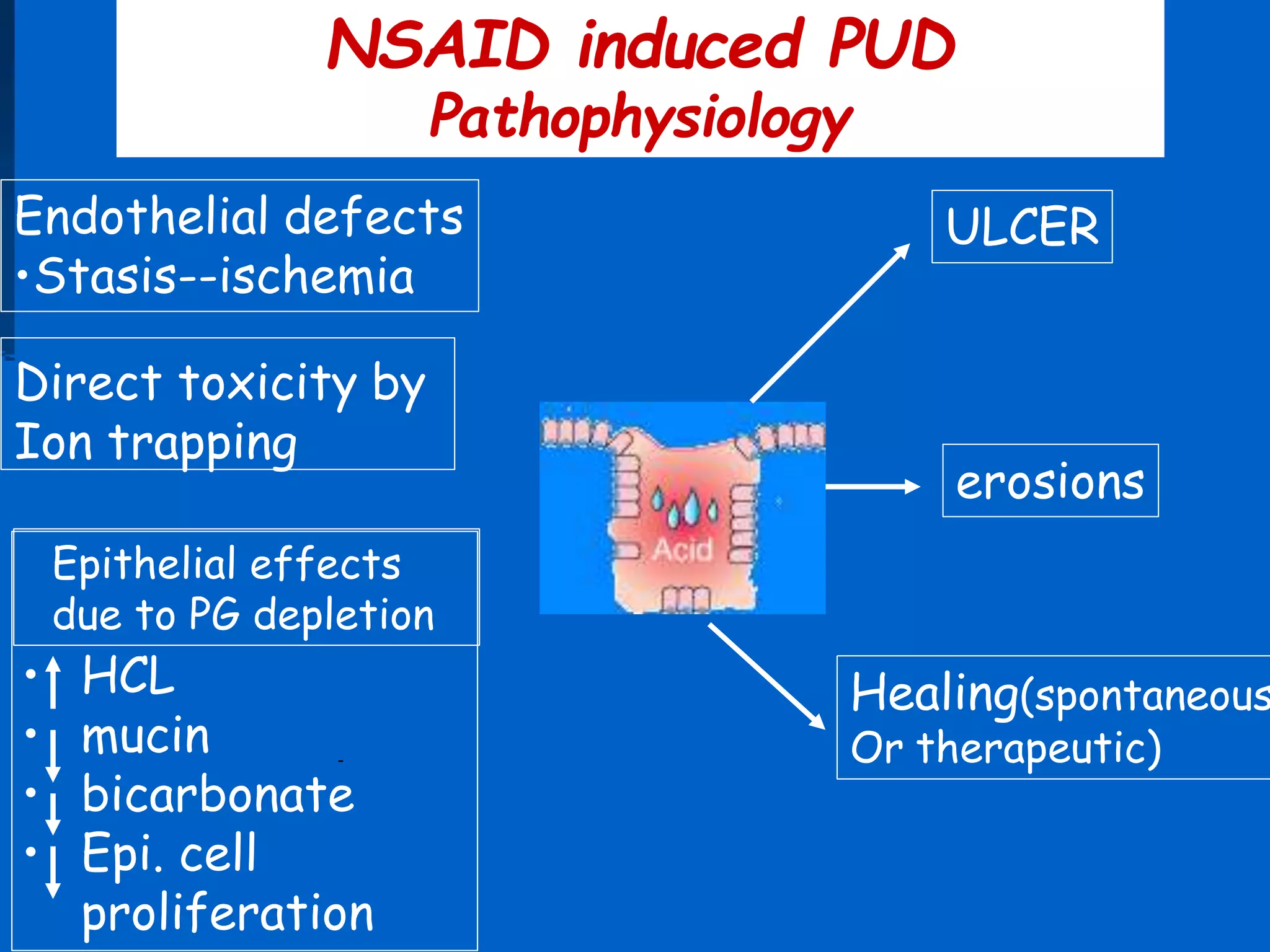 Peptic ulcer disease-child surgery | PPTX