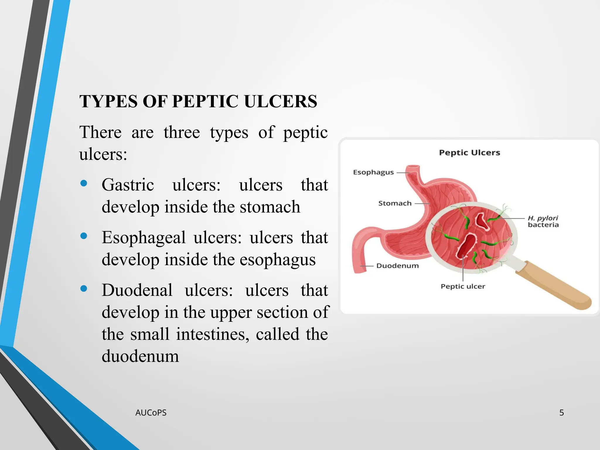 Pharmacotherapy and Pathophysiology of Peptic ulcers | PPTX | Digestive ...