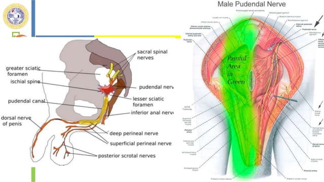 PUDENDALGIA.pptx | Sexual Conditions | Sexual Health