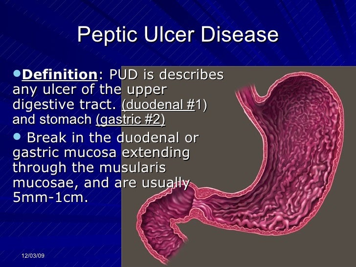 Pud Gastritis Lecture[1]