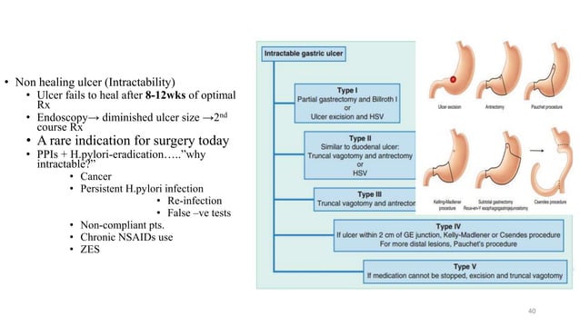 PUD MANAGEMENT mekuria.pptxfghjkkkkkkkkkkkkkkkkk | PPTX | Digestive ...