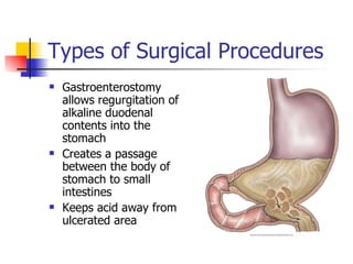 Peptic ulcer disease | PPT